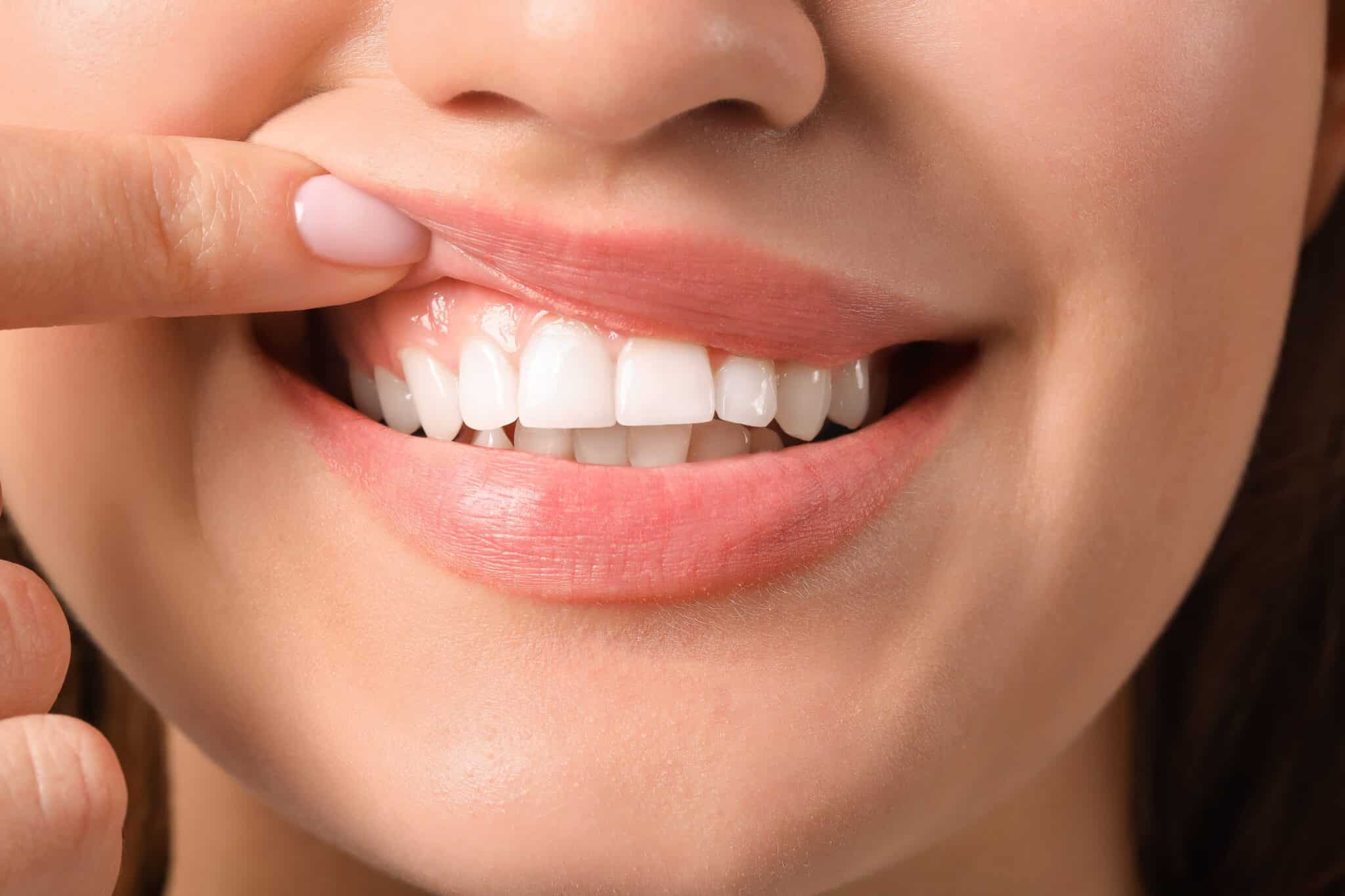 What Do Healthy Gums Look Like? - Wilkinson Dental